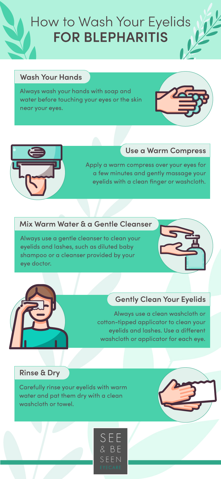 Is Blepharitis Contagious See Be Seen Eyecare